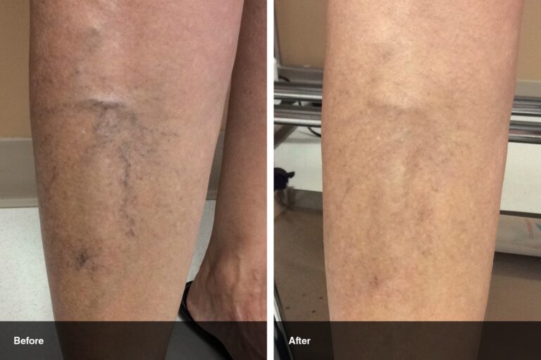 Midwest Vein & Laser Aesthetics in Centerville & Vandalia OH